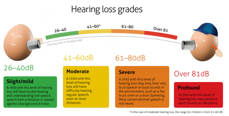 Hearing Aids: The Definitive Guide